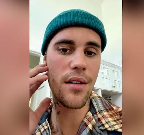 Justin Bieber Shares Message Of Hope After Ramsay Hunt Diagnosis